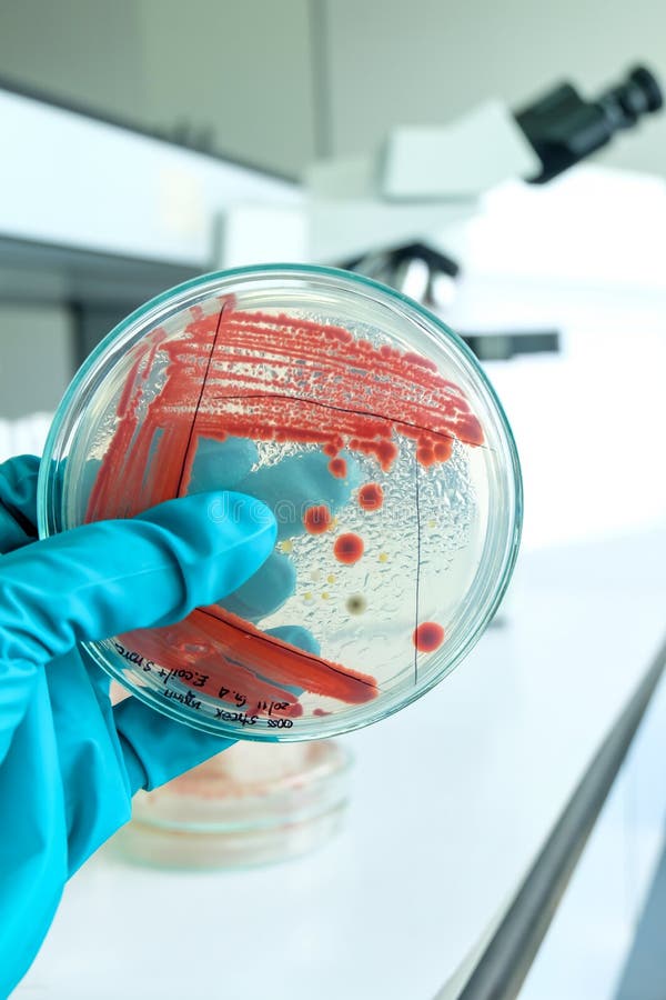 Red Colony of Becteria in Petridish Stock Image - Image of microbiology ...