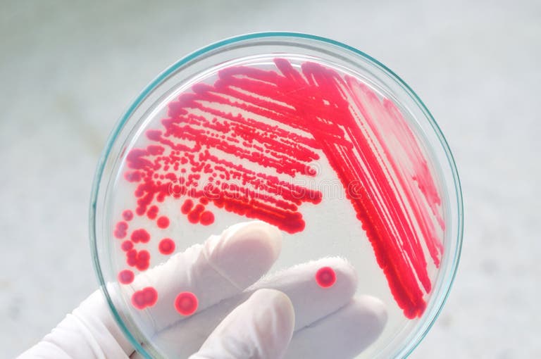 Red colony in petridish stock image. Image of penicillin - 43355283