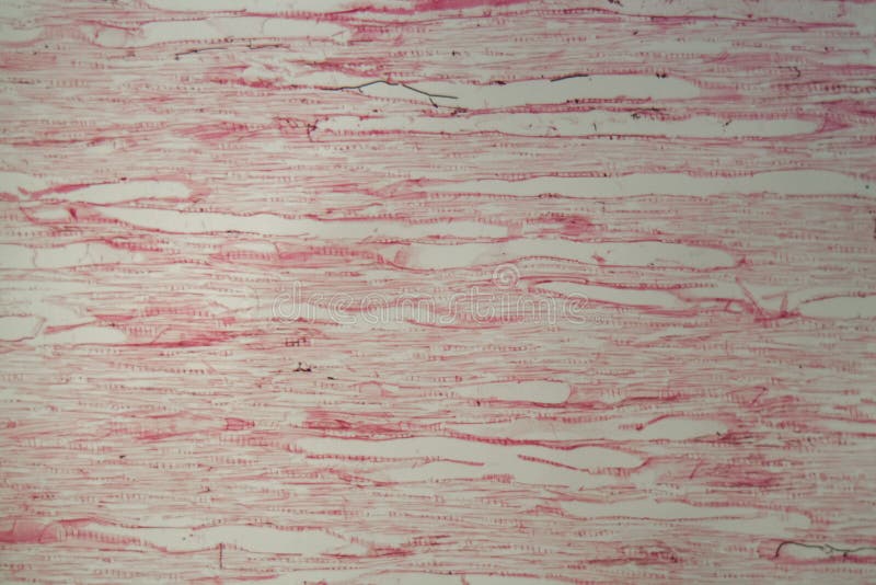 Wood Cells Destroyed by Fungus Under a Microscope Stock Photo - Image ...