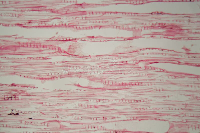 Wood Cells Destroyed by Fungus Under a Microscope Stock Image - Image ...