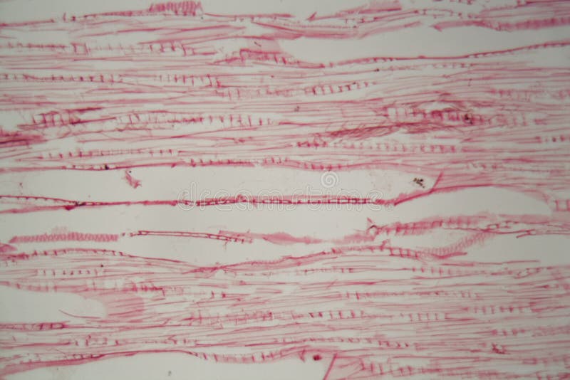Wood Cells Destroyed by Fungus Under a Microscope Stock Photo - Image ...