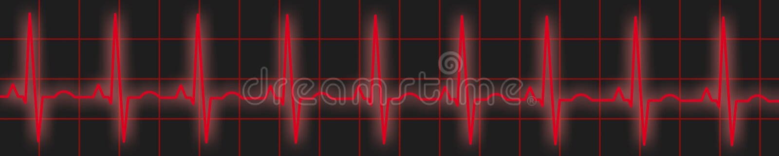 Ecg Pattern Stock Illustrations – 3,478 Ecg Pattern Stock Illustrations ...