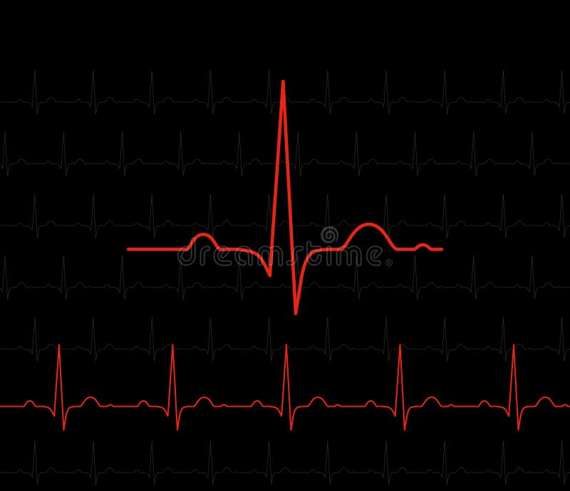 Red EKG Symbol On Black - Medical Background Stock Photo - Image: 38223010