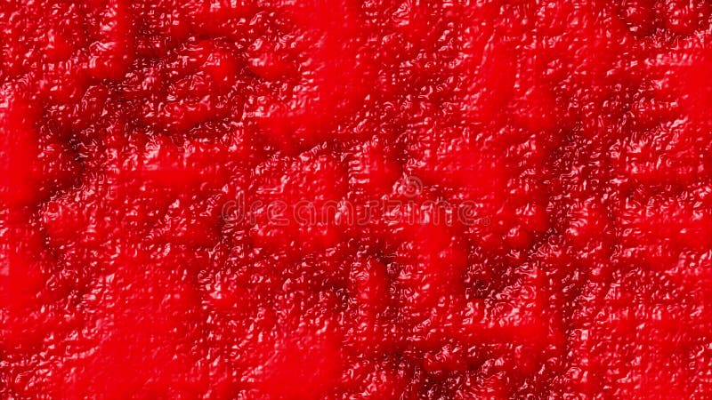 Colon carcinoma disease stock video. Video of microskopy - 196638247