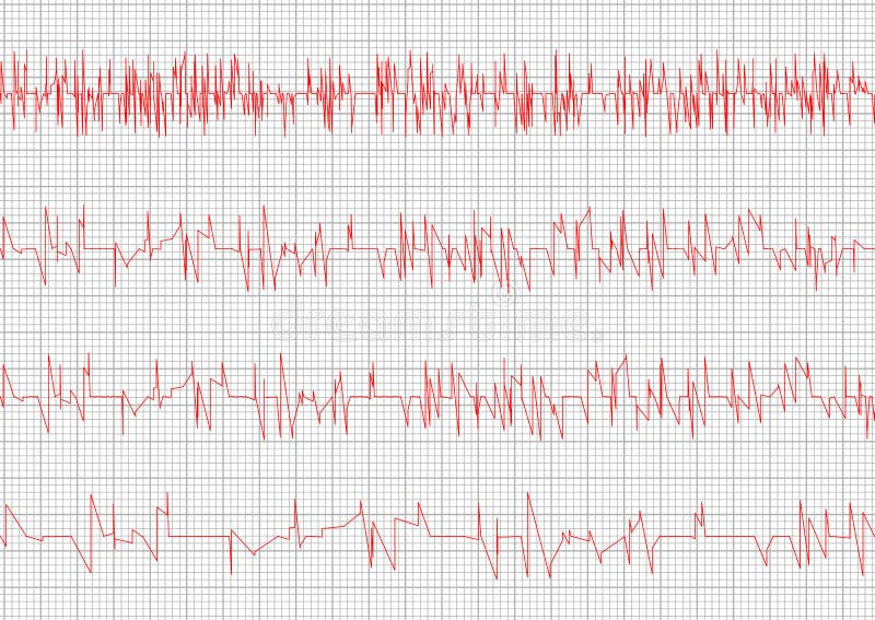 Red Heart cardiogram stock vector. Illustration of analysis - 94370460