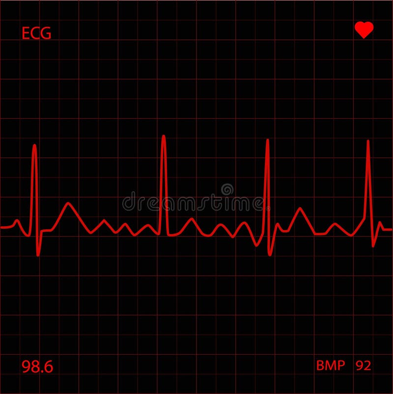 Heart Monitor stock vector. Illustration of line, heartbeat - 14611857