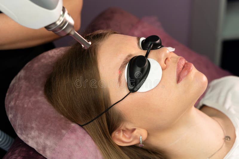 Red Laser Dot Marks Permanent Eyebrow Tattoo Removal in Progress Stock ...