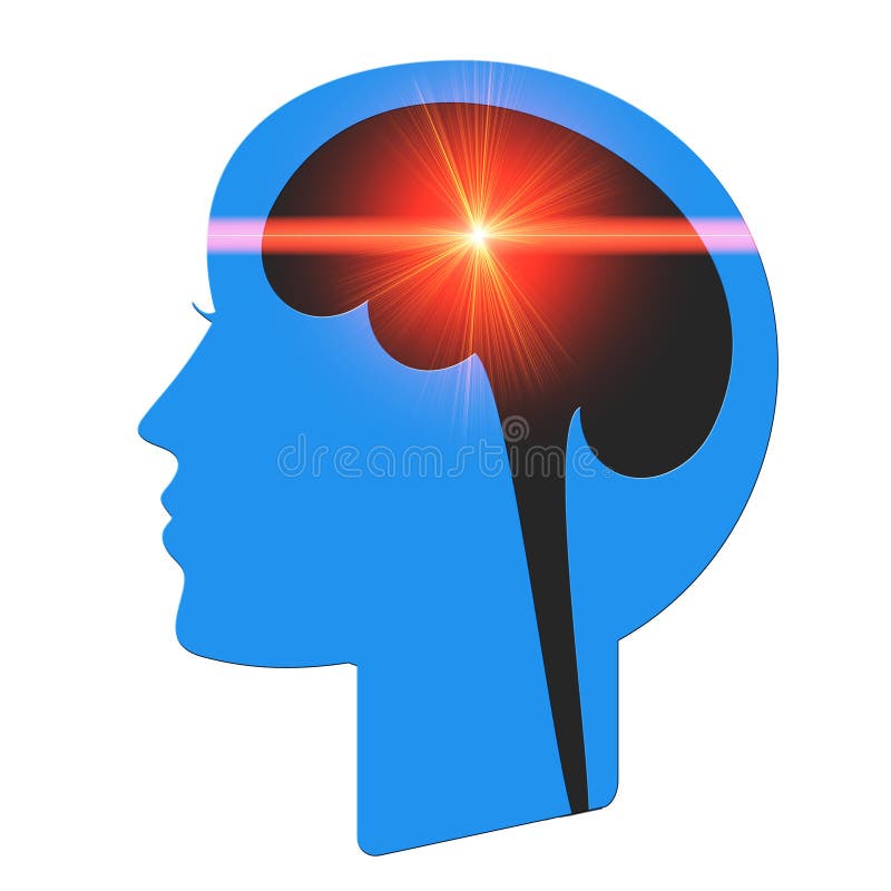 Red light ray in head stock illustration. Illustration of health - 52547781