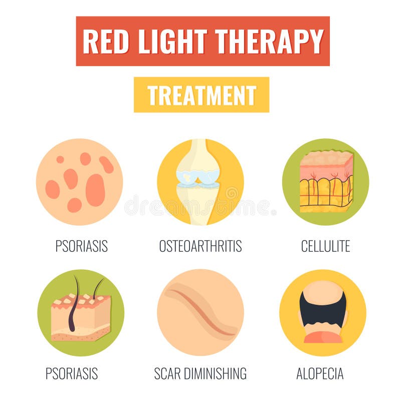 Light Therapy, Phototherapy or Laser Therapy. Depth of Penetration by ...