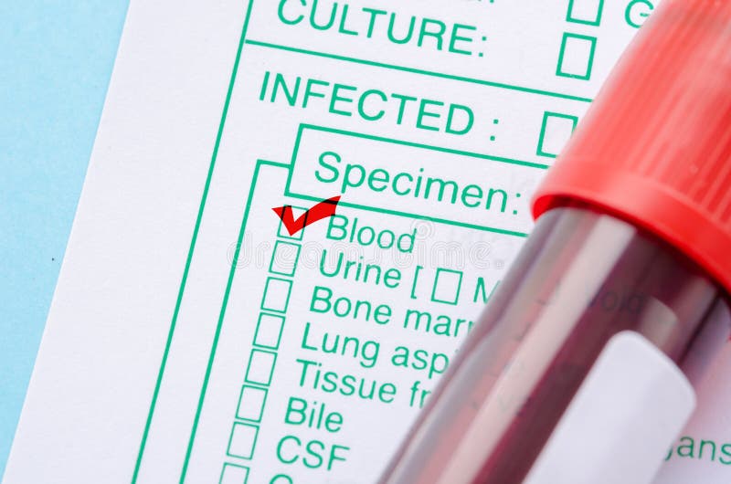 Red Mark on Test Screening Form. Stock Image - Image of leukemia ...