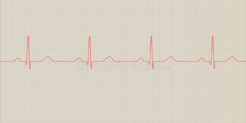 Red Normal Color Cardiogram Human Stock Illustrations – 14 Red Normal ...