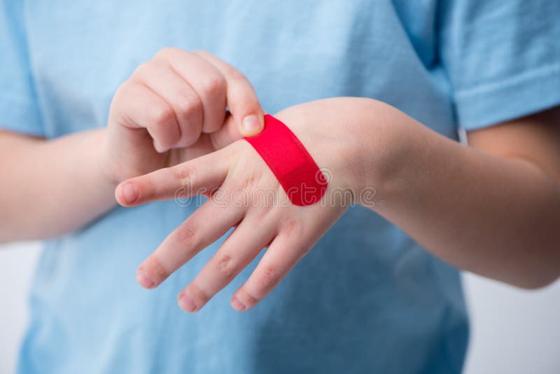 Red patch on hand stock photo. Image of medicine, cropped - 90788650