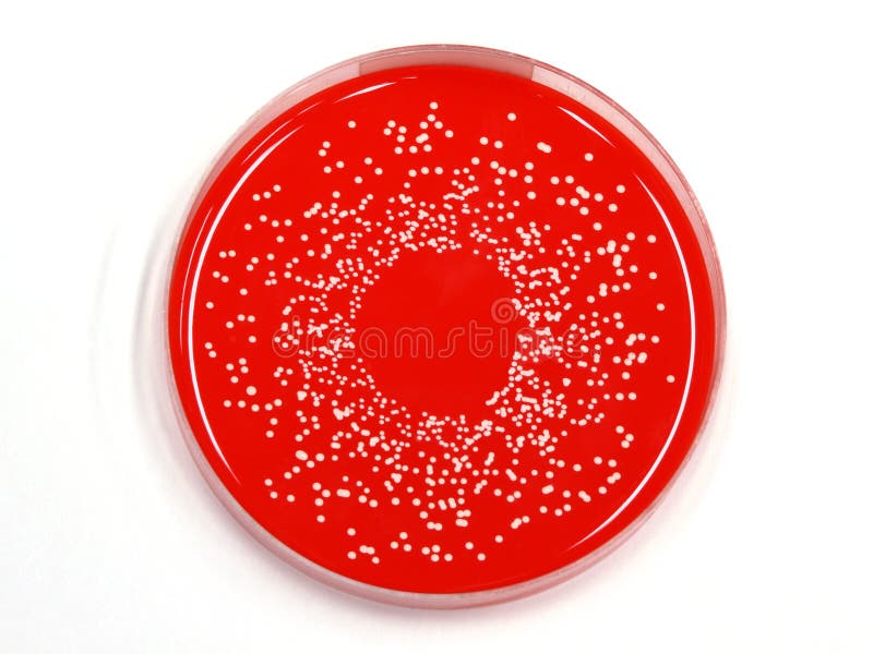 Red Bacterial Colonies on Petri Dish Red Agar Isolated Stock Photo ...