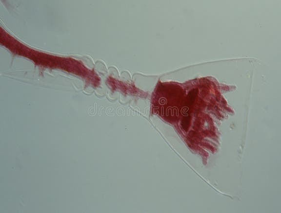 Red Polyp Stick Under the Microscope Stock Photo - Image of organism ...
