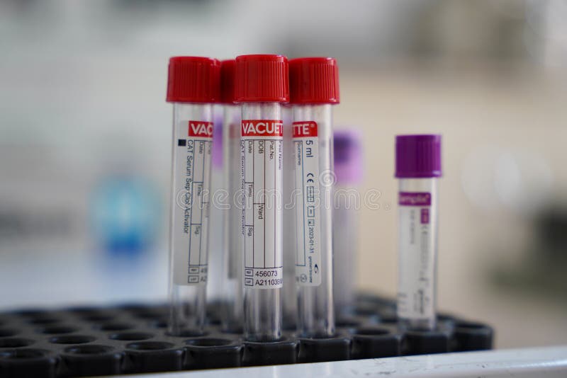 Red Test Tubes in the Laboratory Room Stock Image - Image of equipment ...