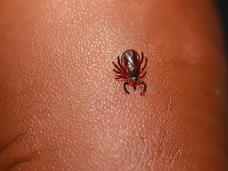 Red tick on the human arm stock illustration. Illustration of macro ...