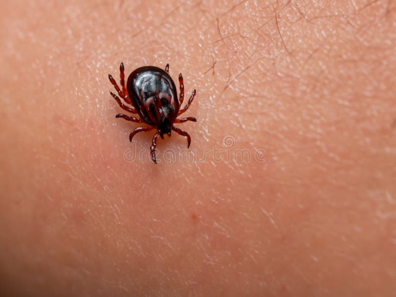 Red tick on the human arm stock illustration. Illustration of human ...
