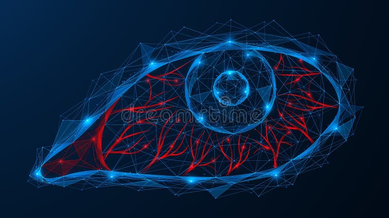 Redness of the Eyes, Blood Capillaries in the Eyeball. Stock Vector ...