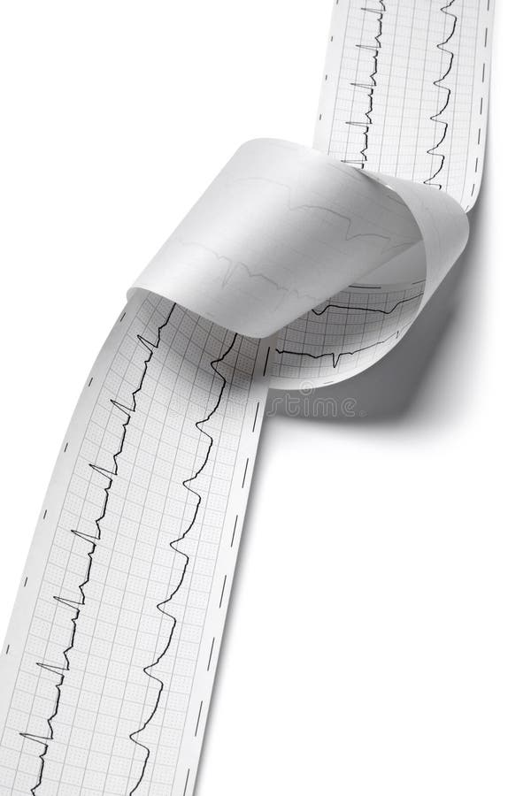 Regular Elektrocardiogram on White Background Close Up Stock Photo ...