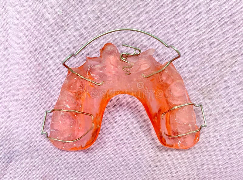 Removable Dental Appliance with Spring for Anterior Crossbite Patient ...