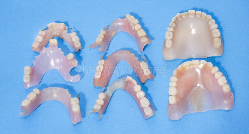Flexible Partial Dentures Top Teeth Stock Photos - Free & Royalty-Free ...