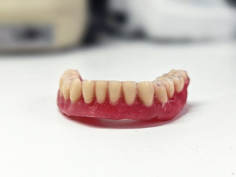Removable Dentures for the Patient are Made in a Dental Laboratory ...