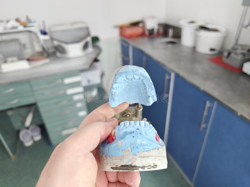 Removable Dentures for the Patient are Made in a Dental Laboratory ...