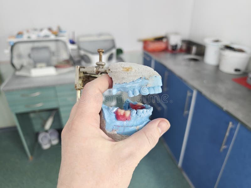 Removable Dentures for the Patient are Made in a Dental Laboratory ...