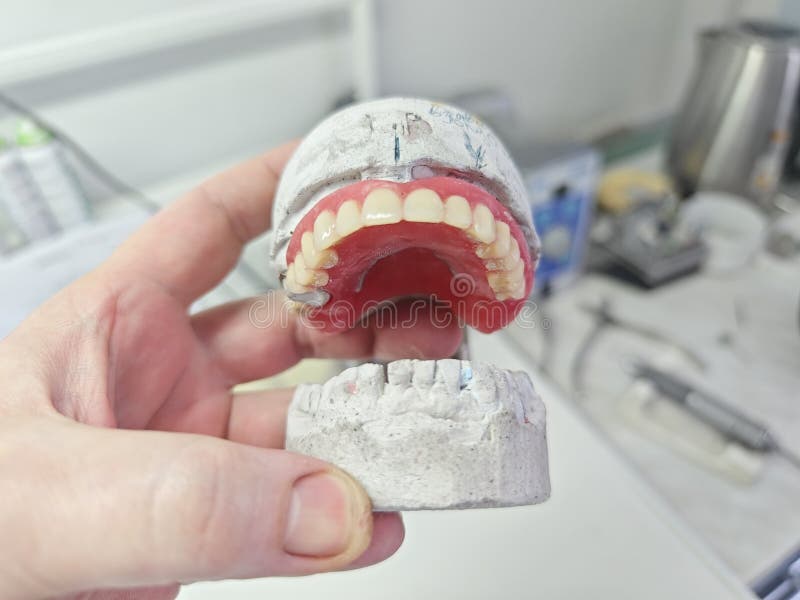 Removable Dentures for the Patient are Made in a Dental Laboratory ...