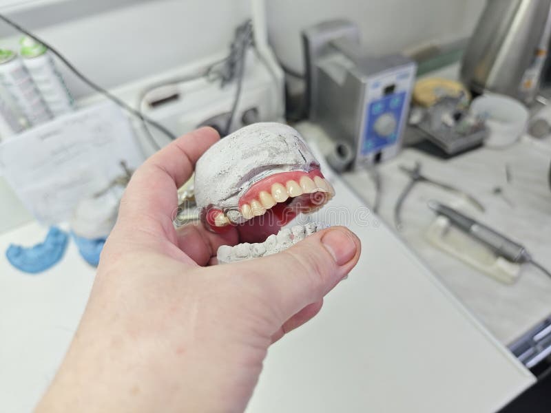 Removable Dentures for the Patient are Made in a Dental Laboratory ...