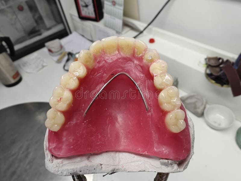 Removable Dentures for the Patient are Made in a Dental Laboratory ...