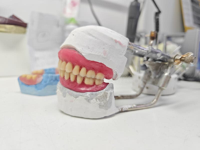 Removable Dentures for the Patient are Made in a Dental Laboratory ...