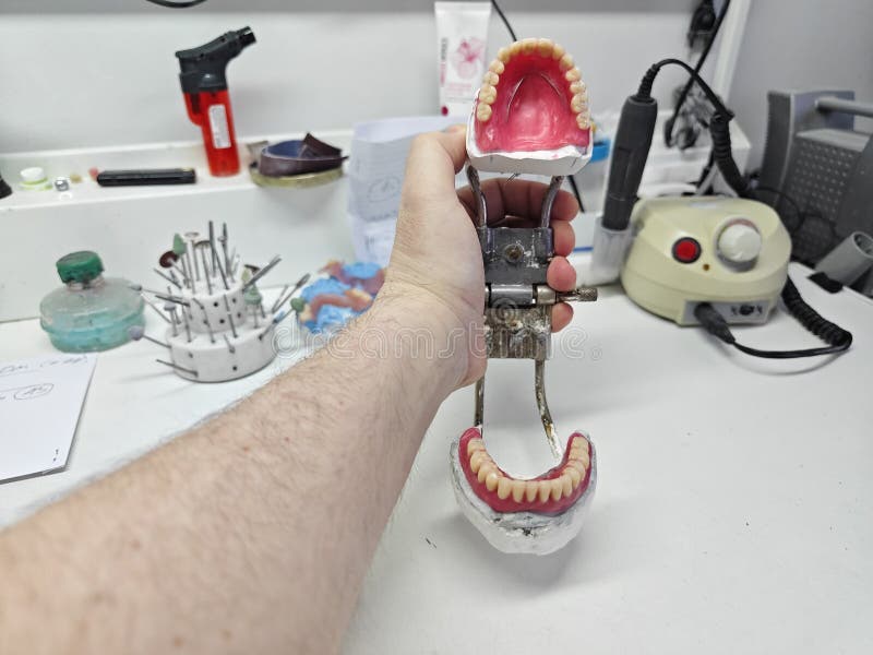 Removable Dentures for the Patient are Made in a Dental Laboratory ...