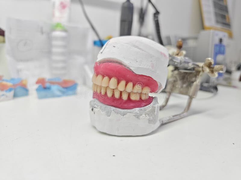 Removable Dentures for the Patient are Made in a Dental Laboratory ...