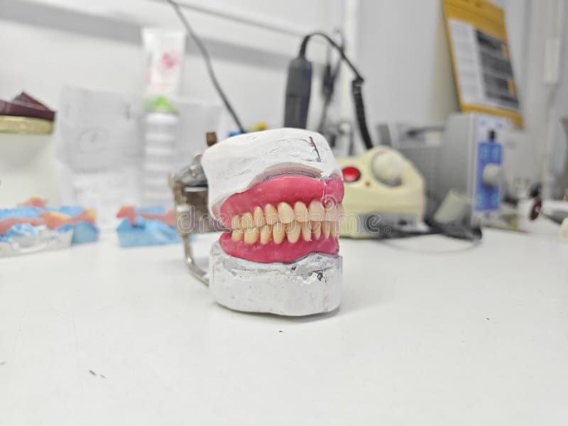 Removable Dentures for the Patient are Made in a Dental Laboratory ...