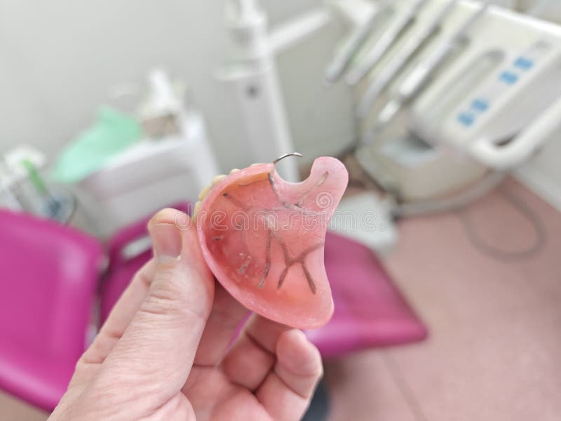 Removable Dentures for the Patient are Made in a Dental Laboratory ...