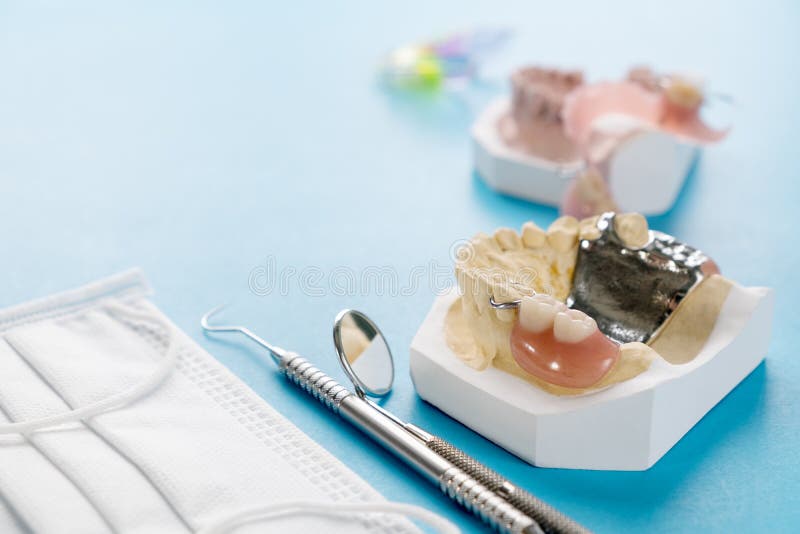 Removable Partial Denture RPD. Stock Image - Image of black, treatment ...