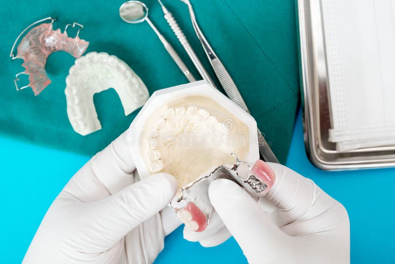 Removable Partial Denture RPD. Stock Image - Image of white, healthcare ...
