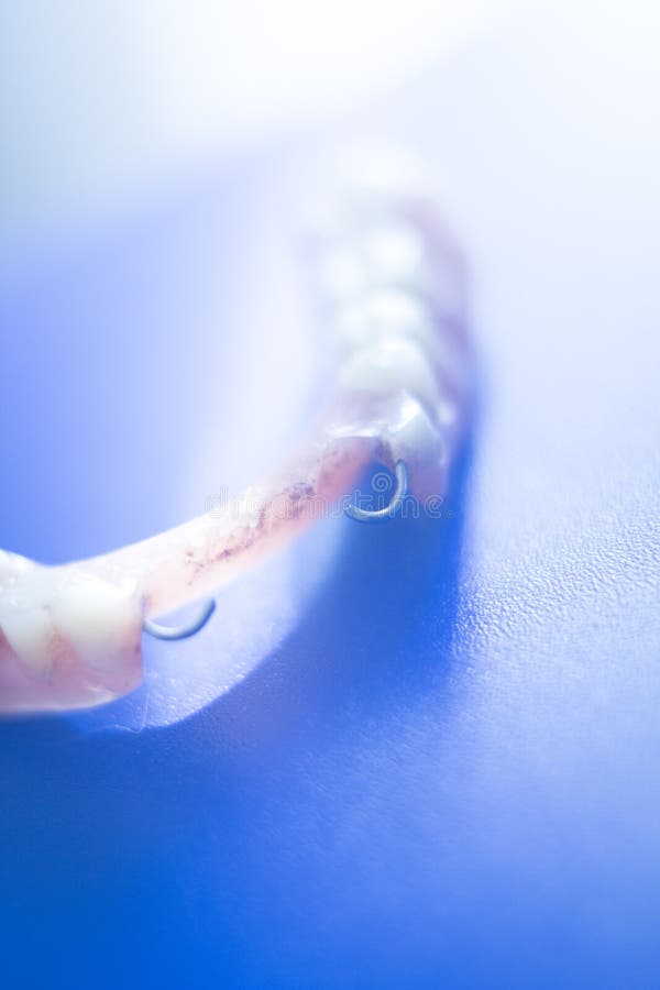 Removable partial dentures stock image. Image of chrome - 64266127