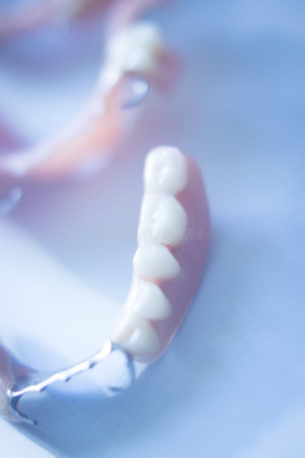 Removable partial dentures stock image. Image of prosthetic - 64266151
