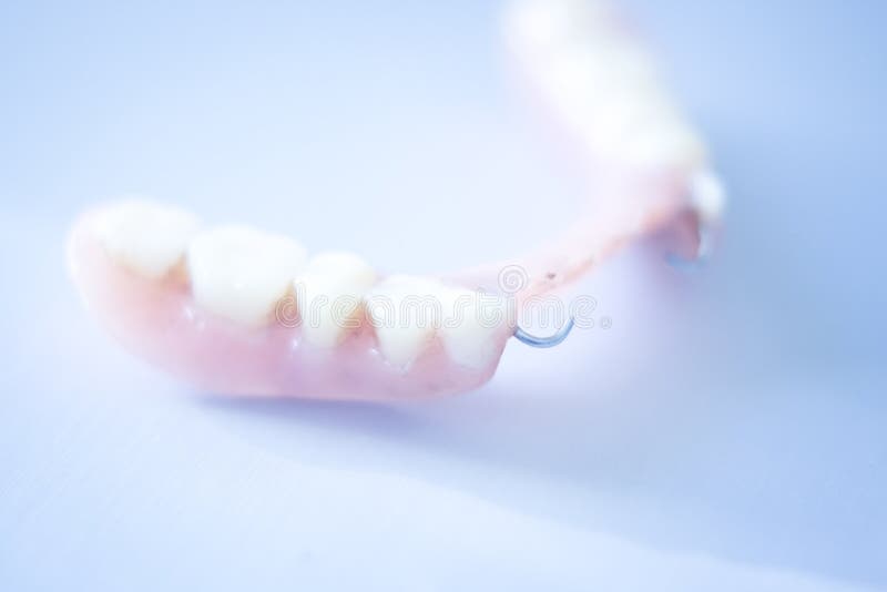Removable partial dentures stock image. Image of orthodontic - 64266057