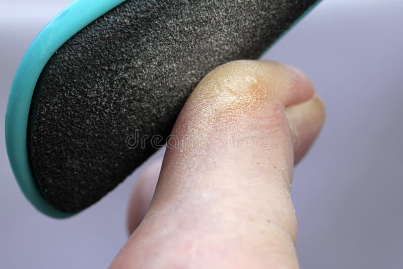 With the file on the toe stock image. Image of keratins - 120610757