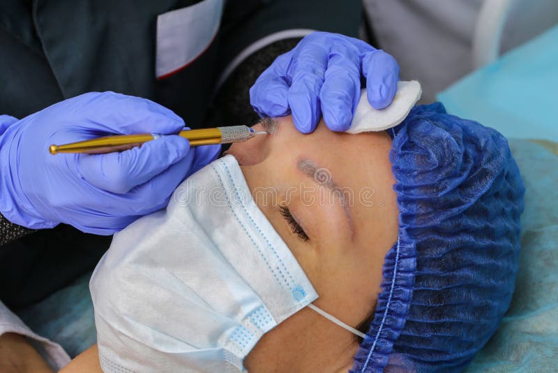 Remove Microblasting Old Makeup. Stock Image - Image of microblooding ...