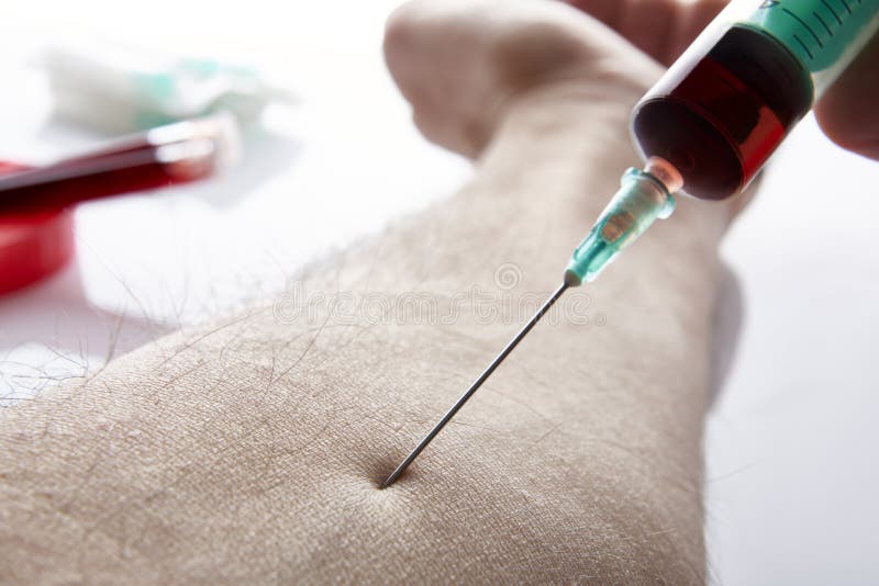 Removing Blood from the Arm of a Person Stock Image - Image of clinic ...