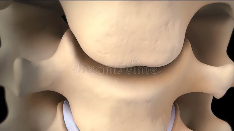 Damaged Disc Stock Illustrations – 510 Damaged Disc Stock Illustrations ...