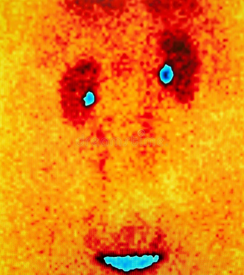Normal Renal Flow in Red and Blue Stock Image - Image of examination ...
