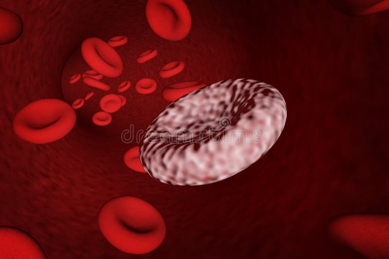 Renderer 3d. Sick Red Blood Cell in the Artery Stock Illustration ...