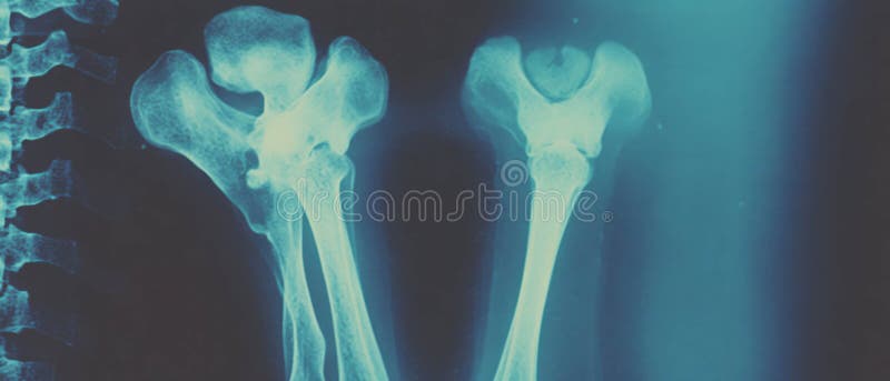 X-ray Texture Pattern Showcasing Uniform Distribution and Consistent ...