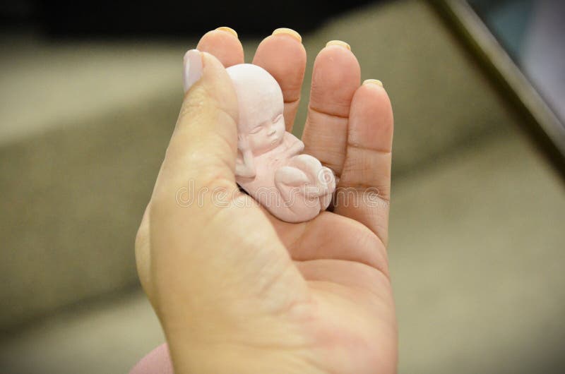 Representation of a 12-week-old Fetus in Plaster on the Palm of the ...