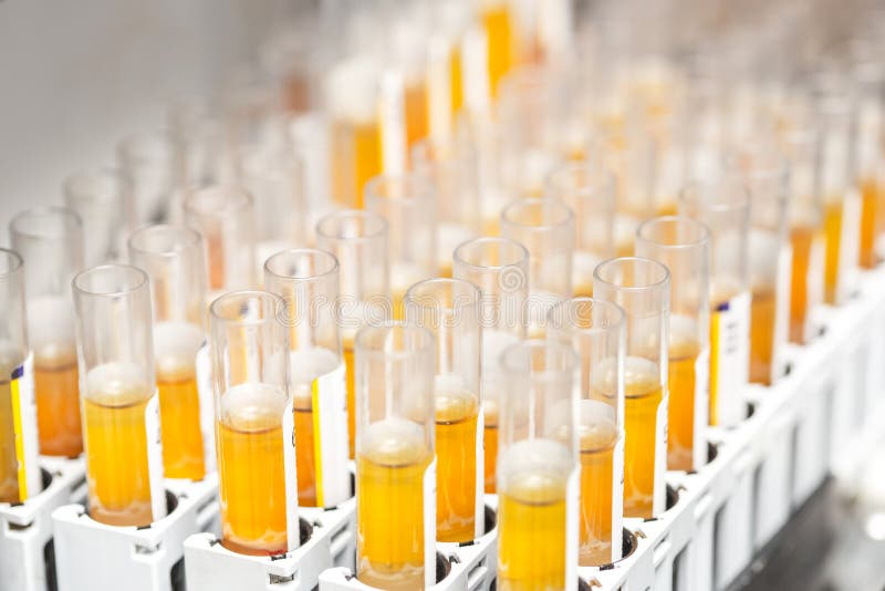 Research in the Laboratory, Test Tubes Stock Image - Image of pipette ...